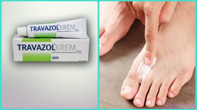 Travazol Kremi Nedir? Nasıl Kullanılır ve faydaları nelerdir ? Fiyatı ...