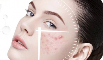Nadixa Krem Nedir? Faydaları Nelerdir?
